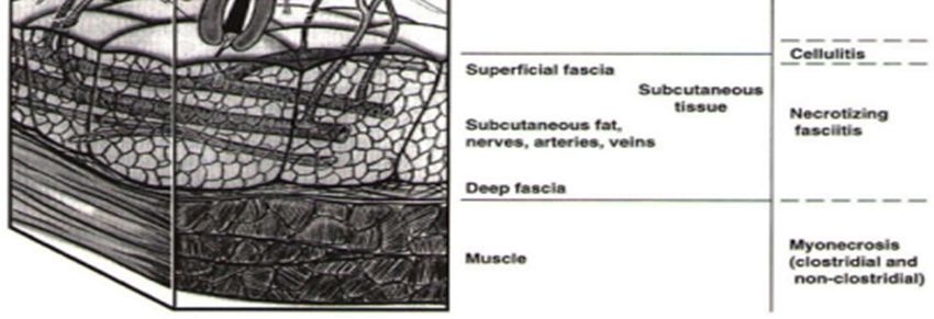 Clinical Pathways Skin and Soft Tissue Infection - (SSTI) Hassan El ...