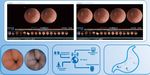 CAPSULE .NAV;EAM TM STOMACH ANX ROBOTICS