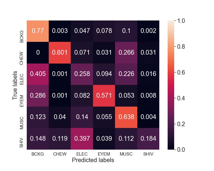 Transformer Convolutional Neural Networks For Automated Artifact Detection In Scalp Eeg