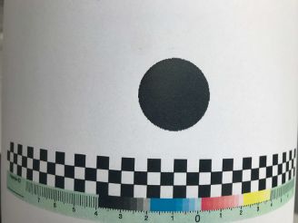 Detecting and Measuring Surface Area of Skin Lesions - Pattern ...